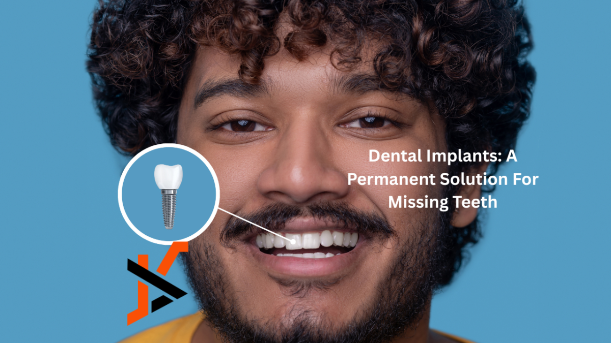 Dental Implants: A Permanent Solution For Missing Teeth - Tech k Times